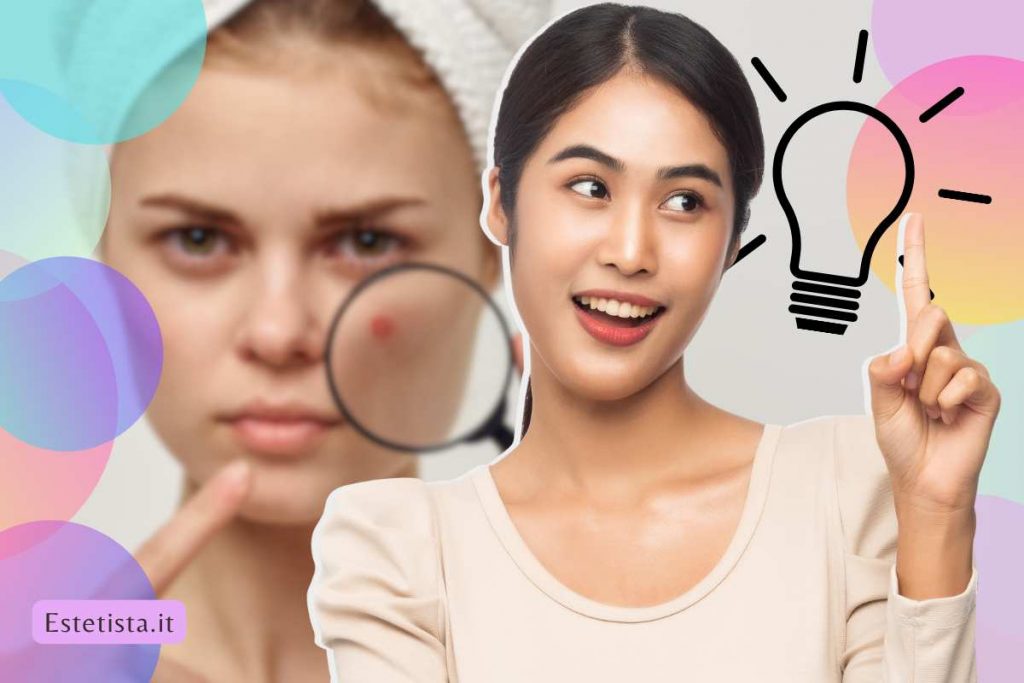 Ti svegli e ti ritrovi con un brufolo e non sai come fare? È più ...