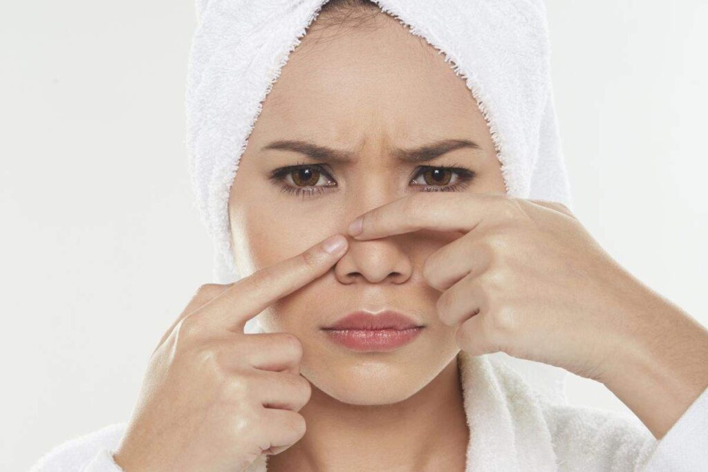 Pelle piena di puntini bianchi? Come eliminarli in modo efficace ed ...